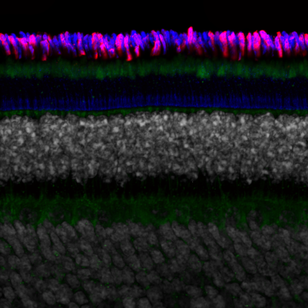 Assessment of Outer Retinal Remodeling in the Hibernating 13-lined ...